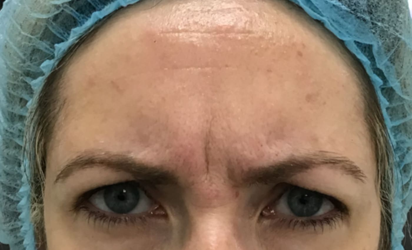 Gallery - Distinct Medical Aesthetics