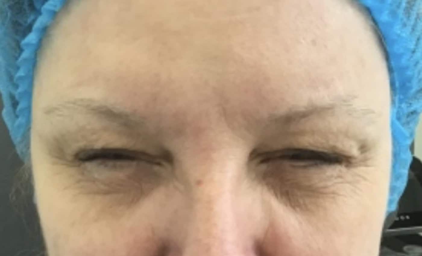 Gallery - Distinct Medical Aesthetics